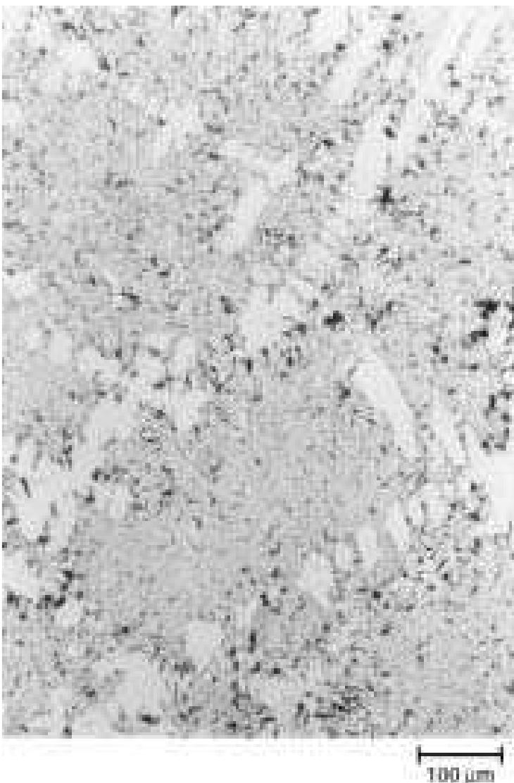 (PDF) Metallography and Microstructures of Cast Iron