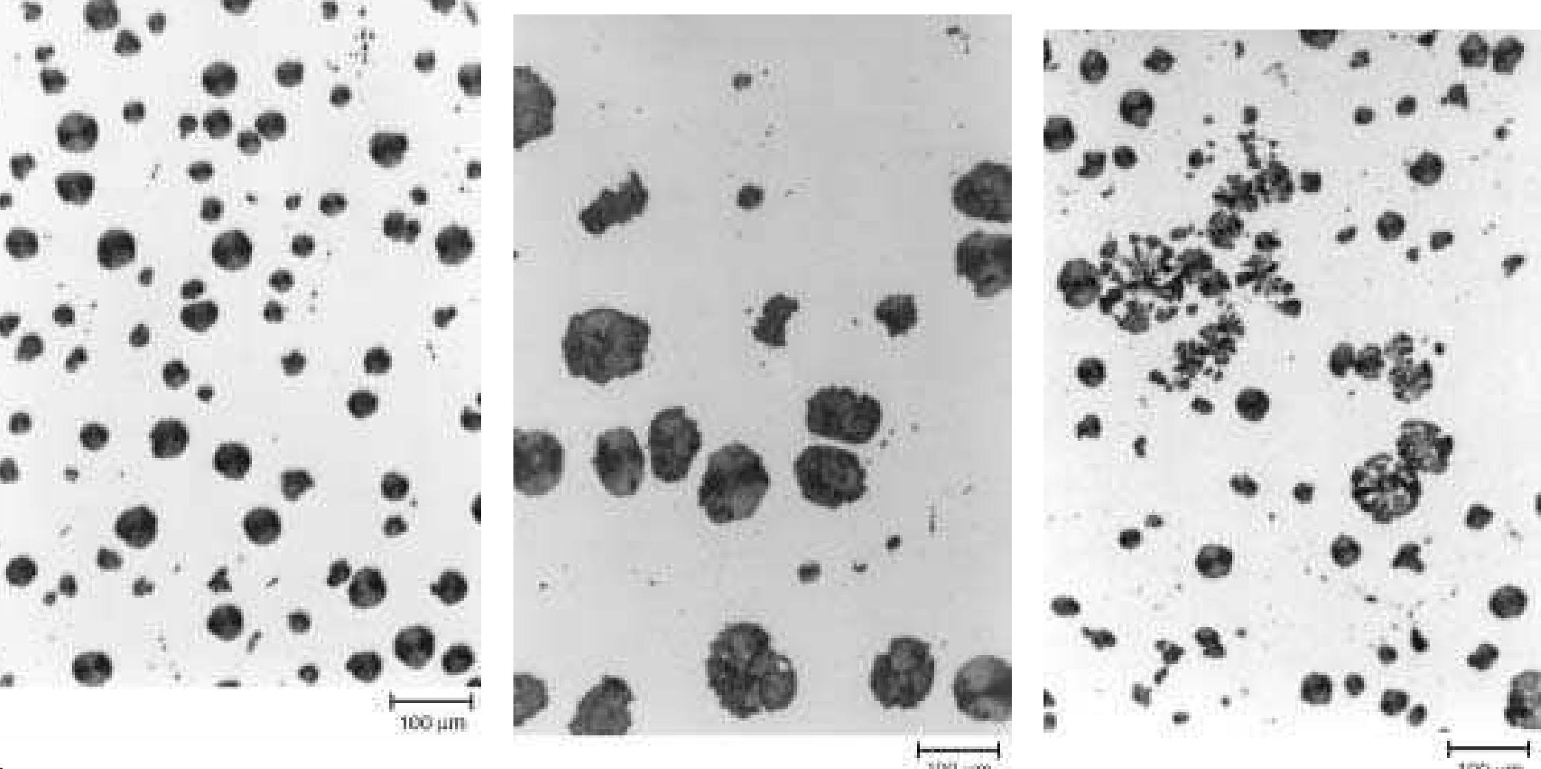 (PDF) Metallography and Microstructures of Cast Iron