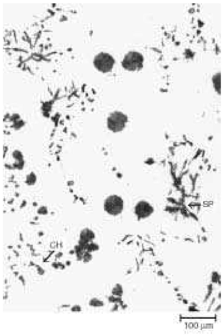 (PDF) Metallography and Microstructures of Cast Iron