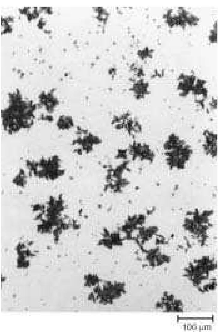 (PDF) Metallography and Microstructures of Cast Iron