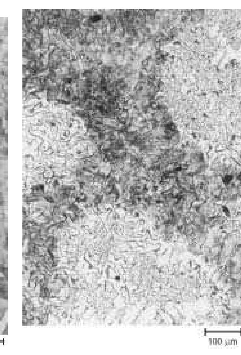 Figure 83 - Metallography and Microstructures of Cast Iron