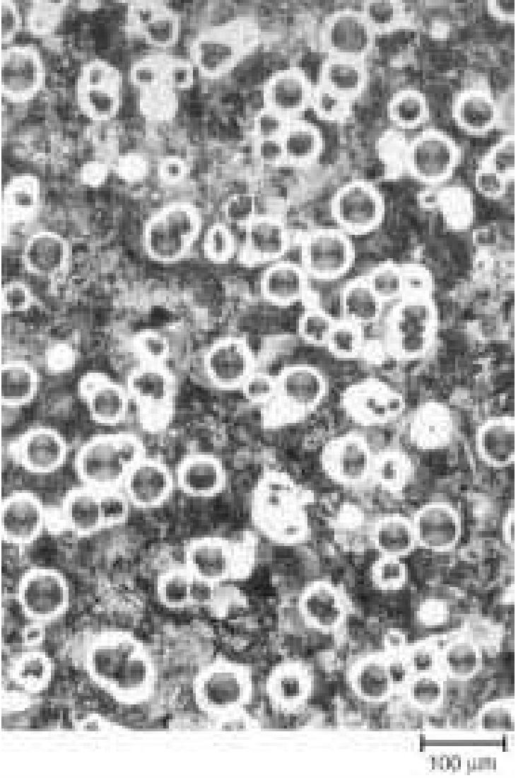 (PDF) Metallography and Microstructures of Cast Iron