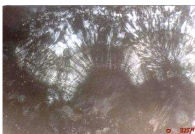 “the concentric narrow ial fibres are shown under the