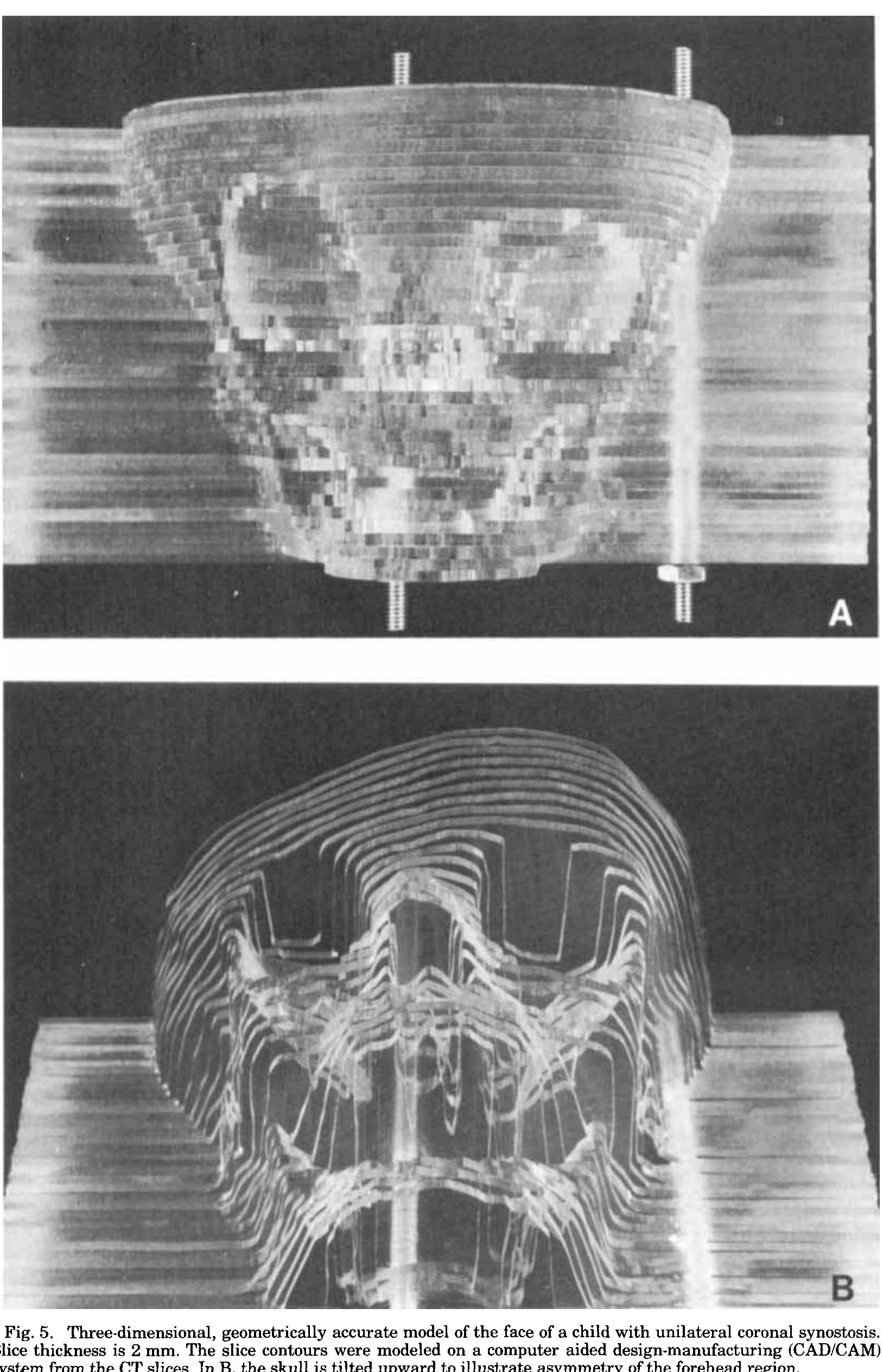 Figure 9 Three Dimensional Cranial Surface Reconstructions