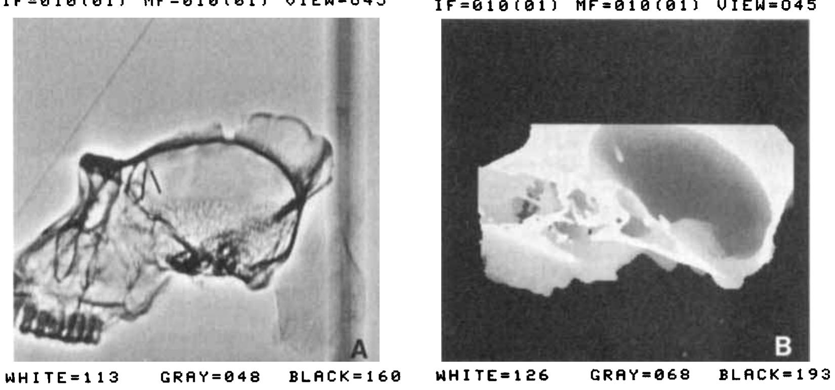 Ig. 6. surface reconstructions from ct scans of a gorilla