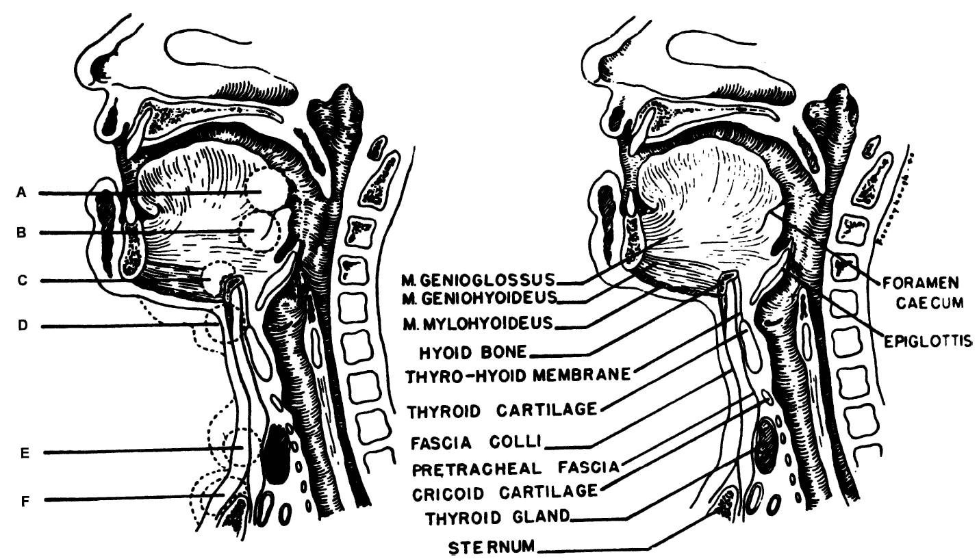 53. various locations of thyroglossal duct cysts. (a) in