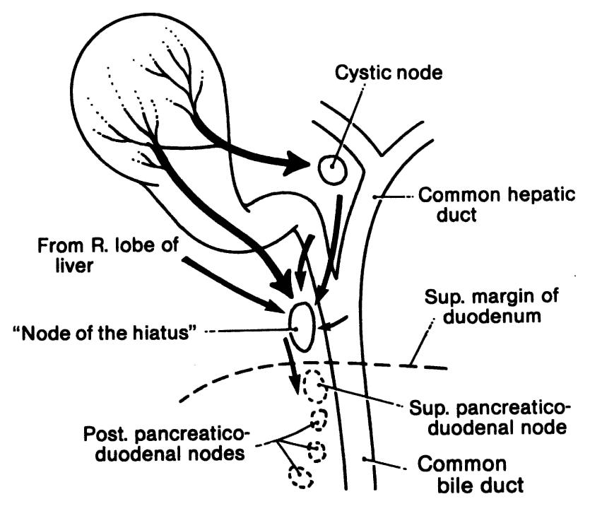 10. lymphatic drainage of the biliary tract. the cystic node