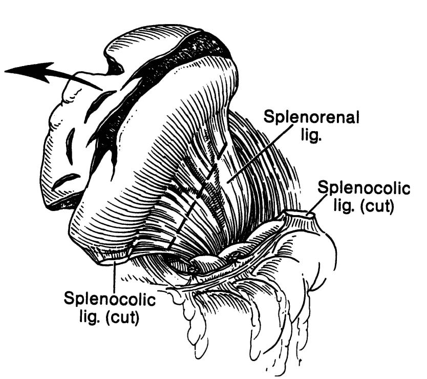16. medial position of the spleen during the posterior