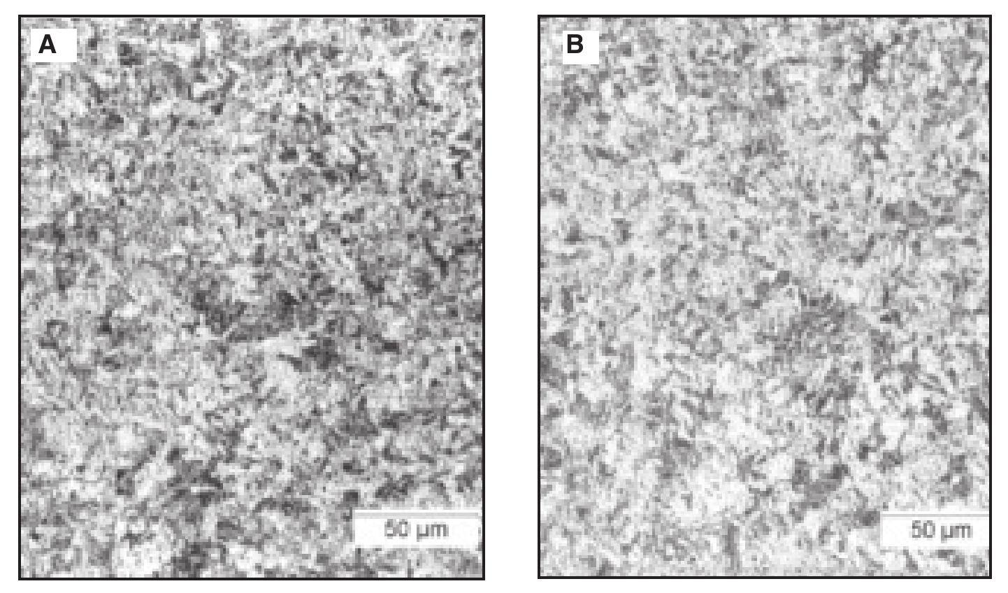 microstructure of twice-reheated areas in weld al. a —