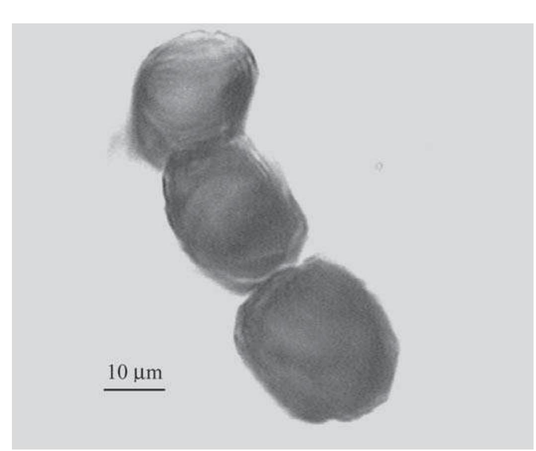Microscopic photograph of cross-section of wool fibers
