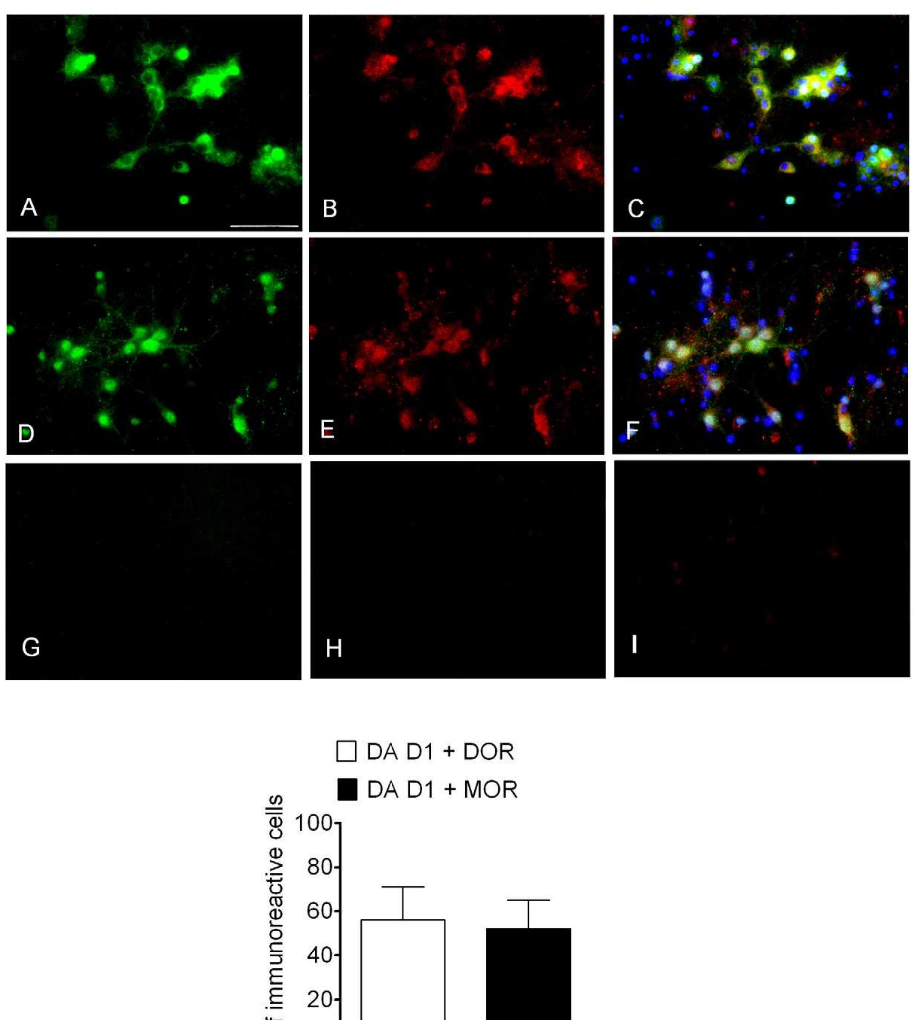 Double immunofluorescence labeling of da d1 receptors, 5-