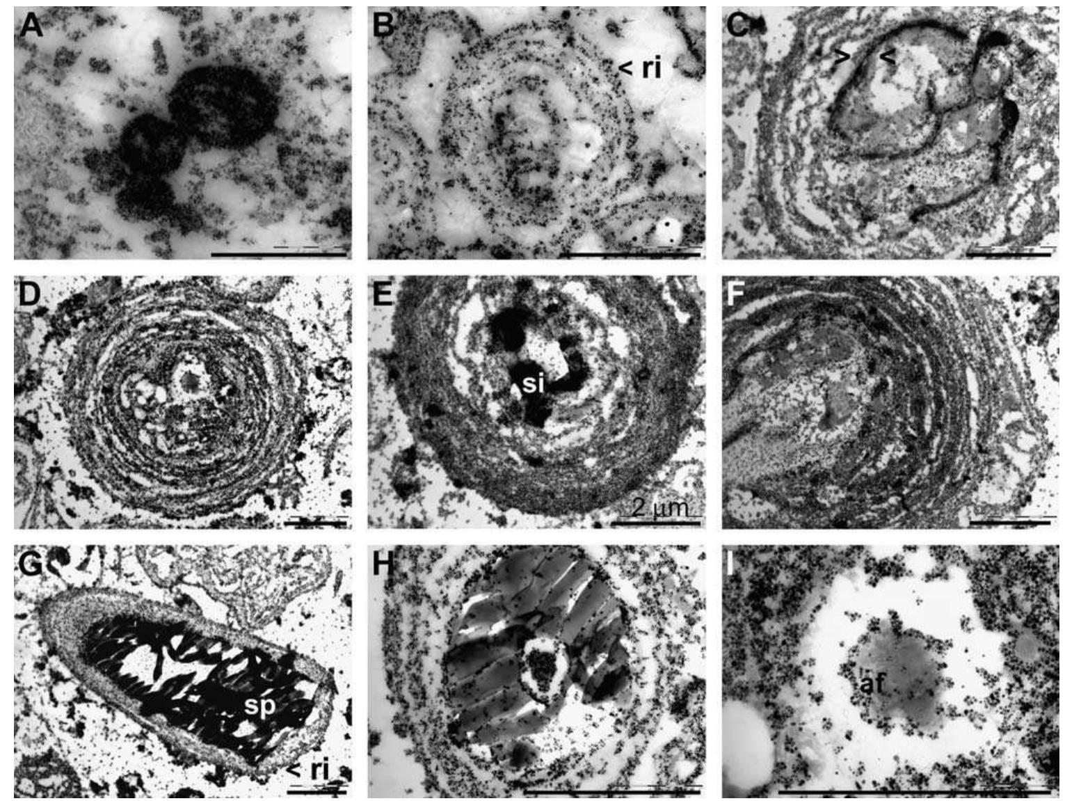 Immunogold electron microscopy of cross sections through