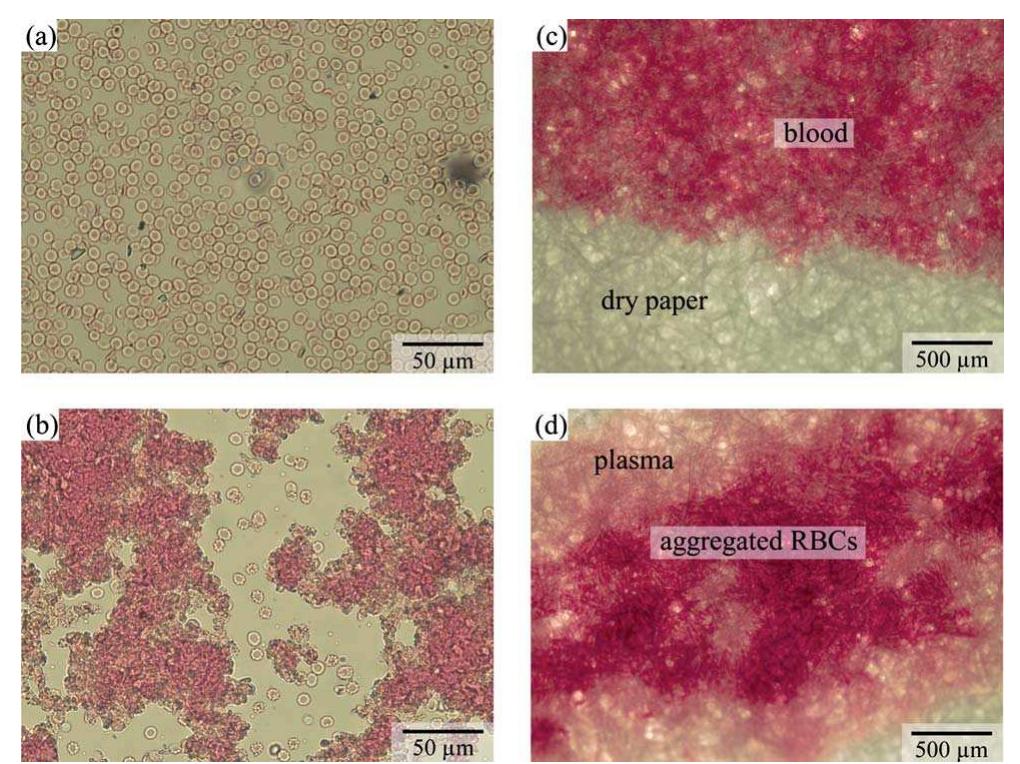 Rbc agglutination in the presence of agglutinating