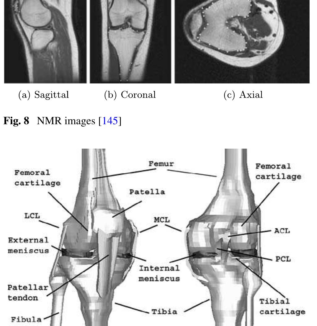 Finite element model of the knee joint [145] bones were