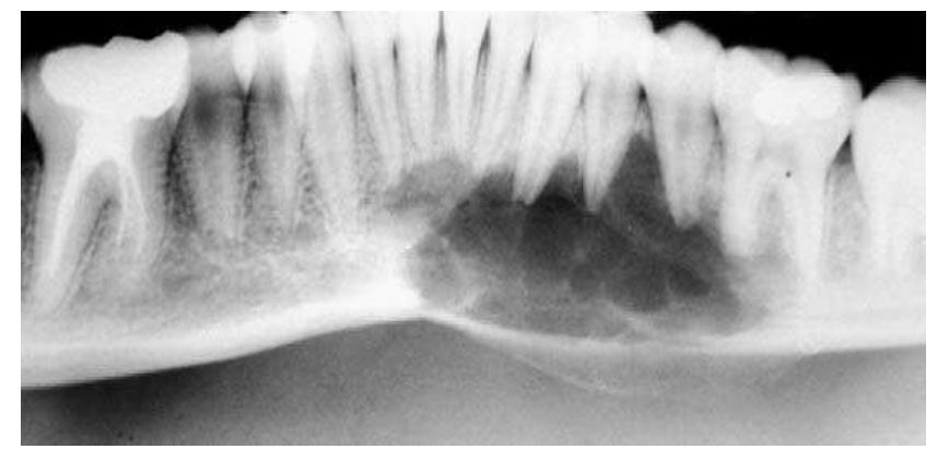 3. results fig. 5. radiograph of the mandible showing