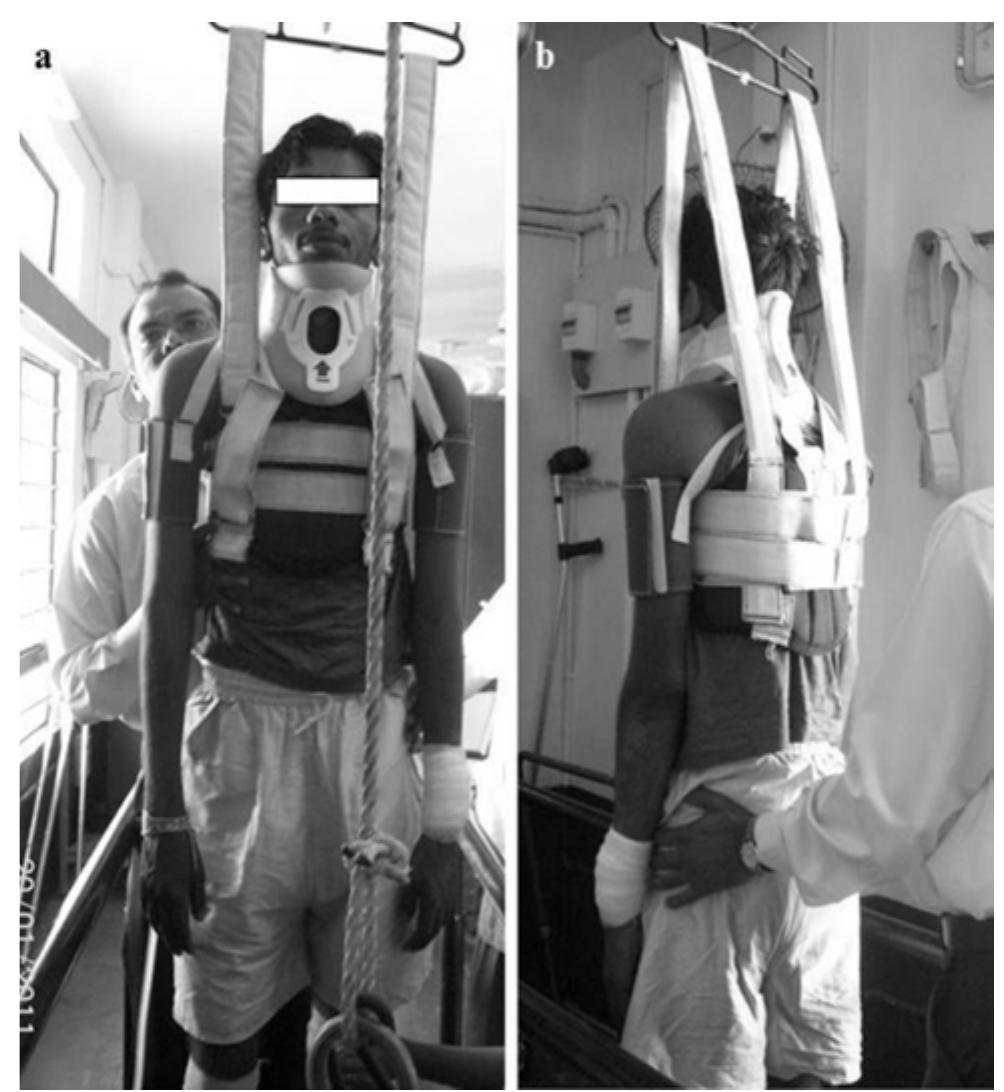 Gait training using bwsot with pelvic support (a) anterior