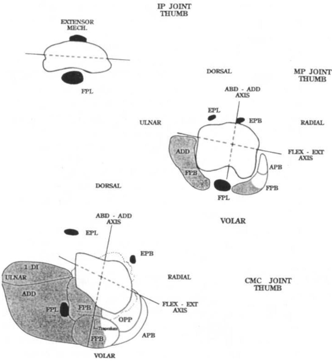 A low median nerve palsy affects the opponens, the abductor