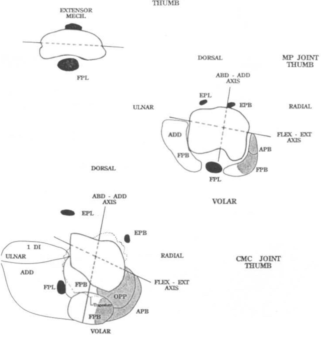An ulnar nerve palsy is devastating to the thumb. the white
