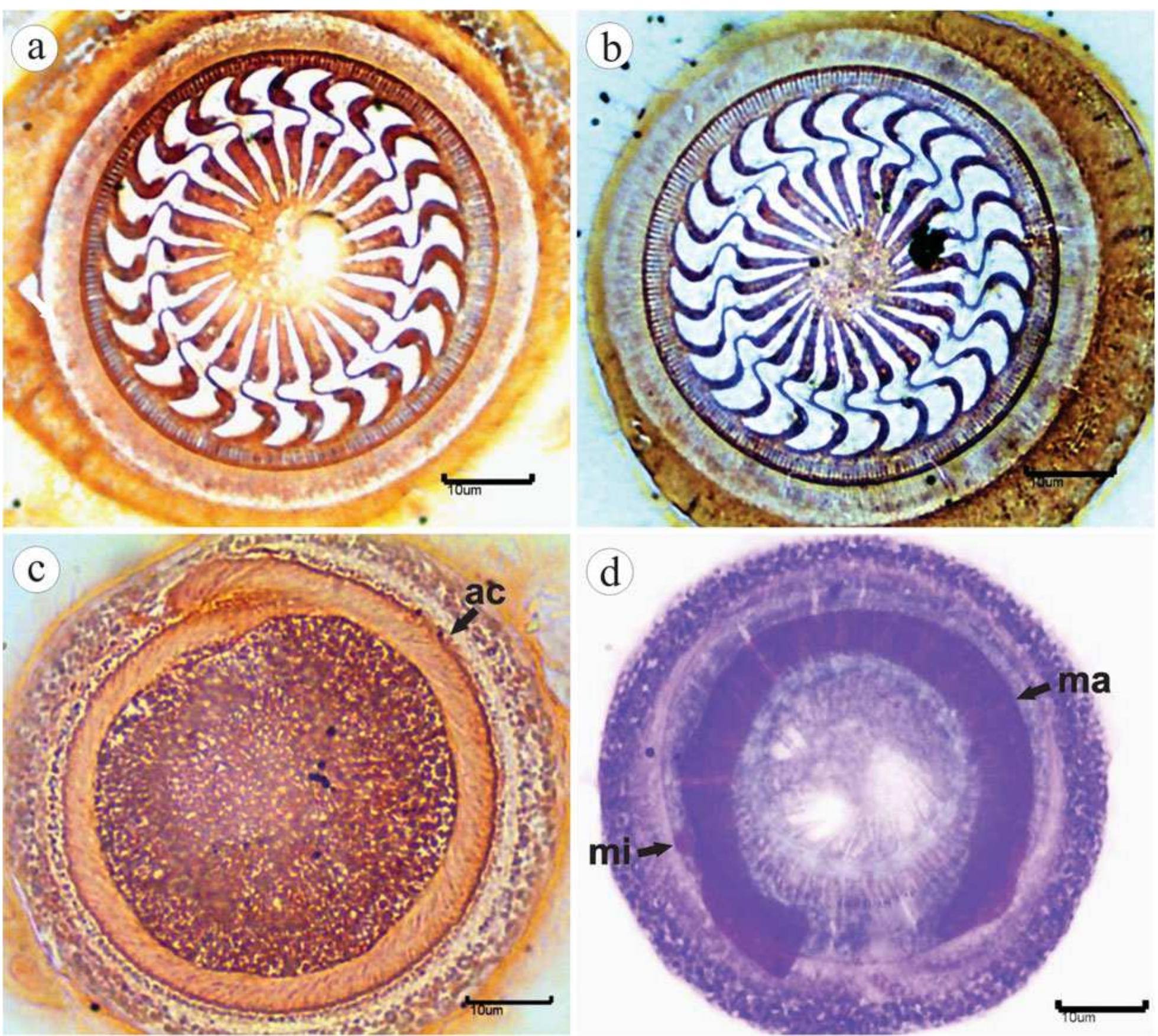 Klein’s silver-impregnated specimens of trichodina