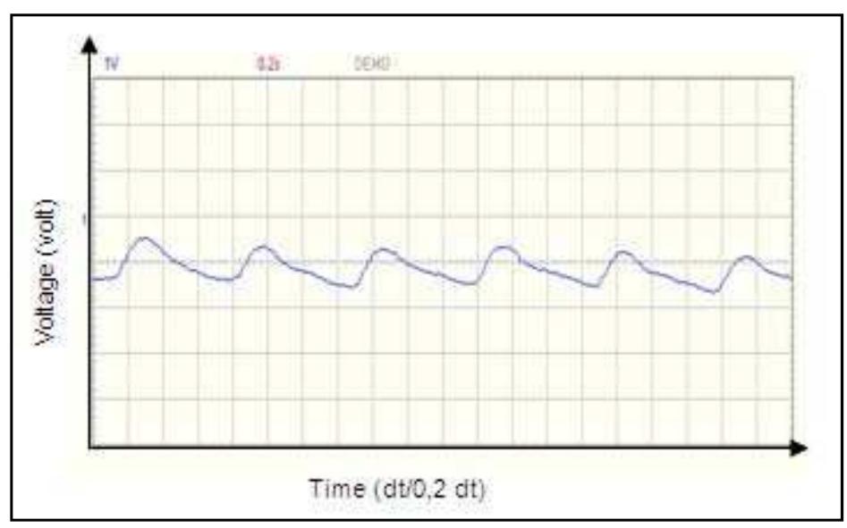 -8. pulse wave recording ecg normal subject 6. figure-7.