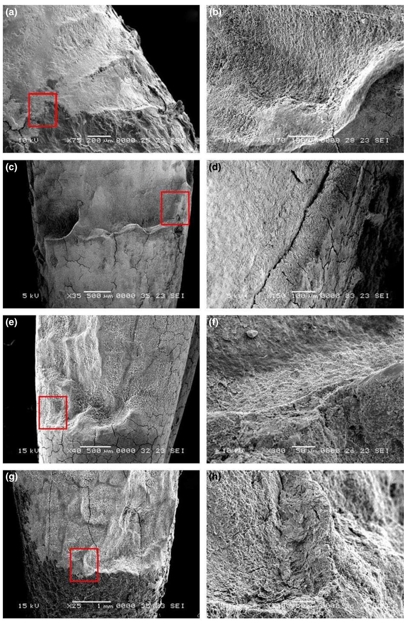 Scanning electron microscope micrographs of samples treated
