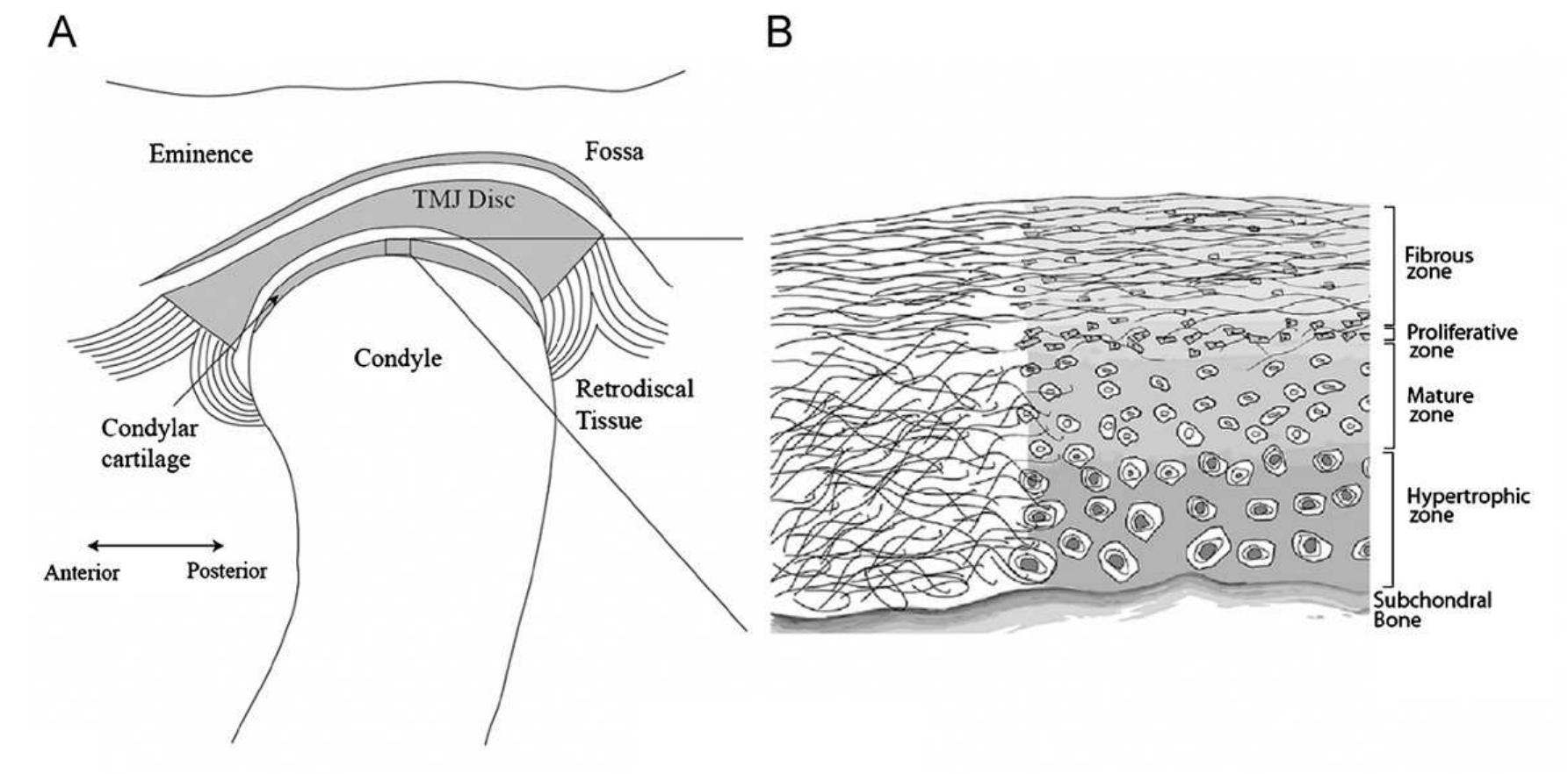 (a) schematic of a sagittal section of the human tmj,
