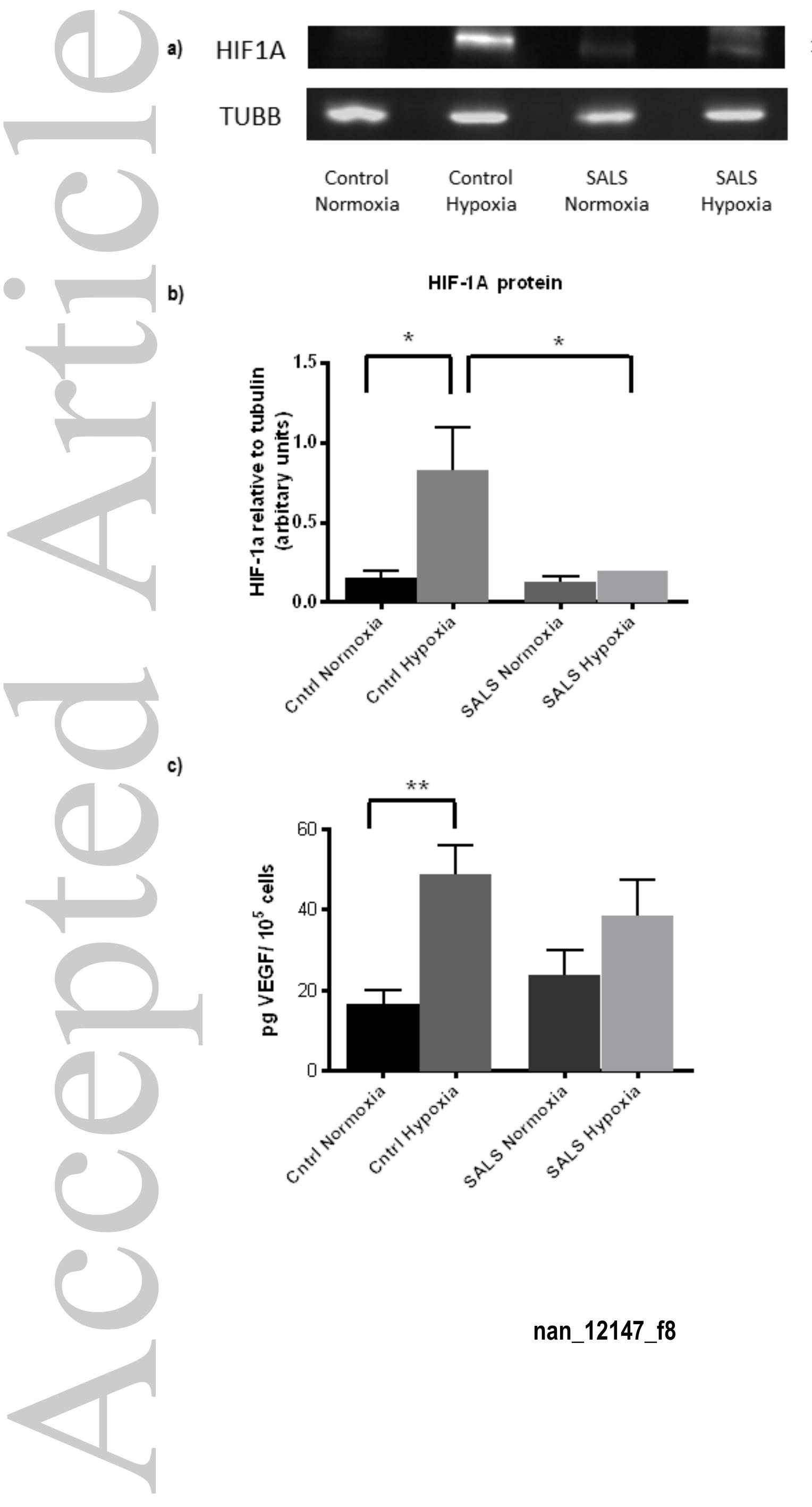 Figure 6 - Gene expression signatures in motor neuron