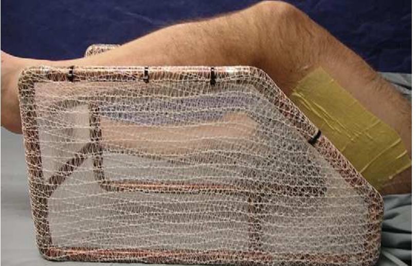 Figure 9 - Positioning, splinting, and contracture