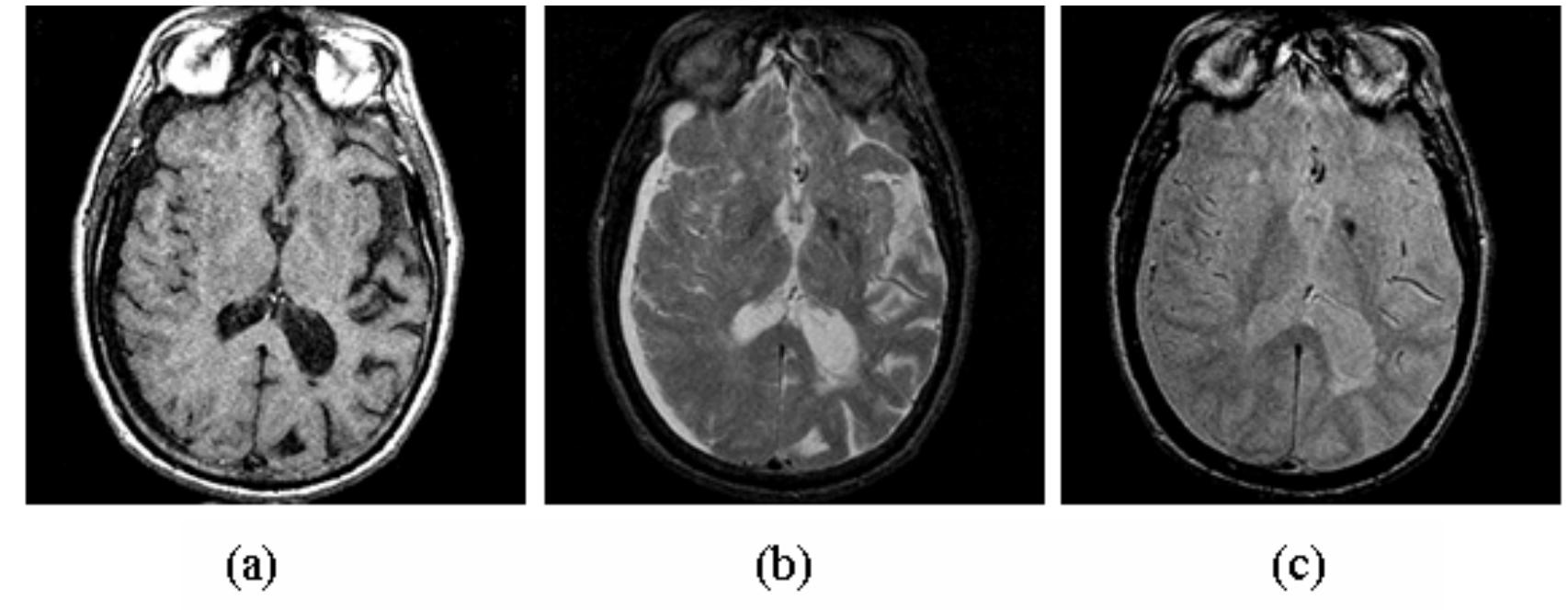 Types of mri axial scan (a) t1 scan (b) t2 scan (c) pd scan