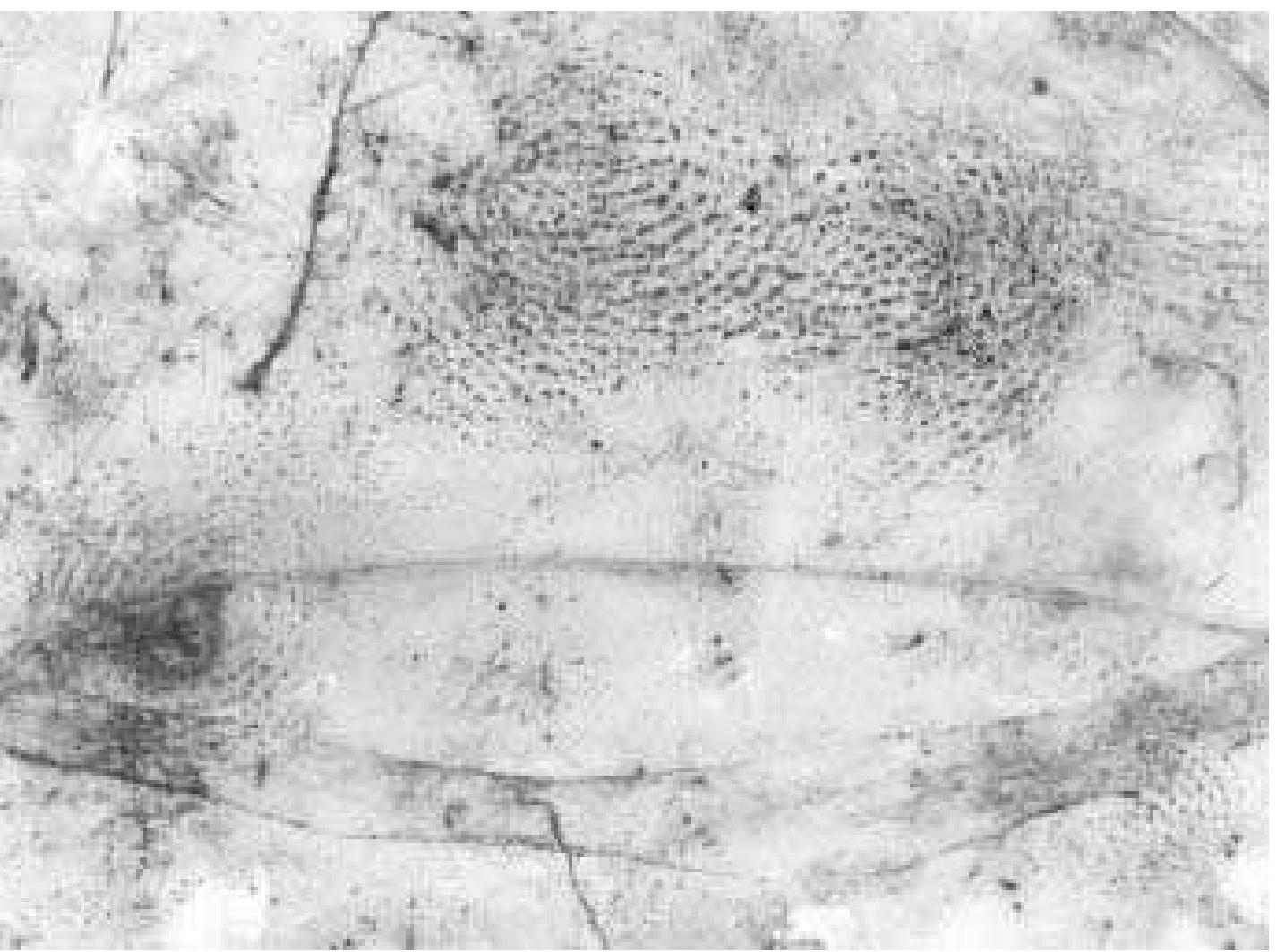 B. these two images show one common type of distortion that