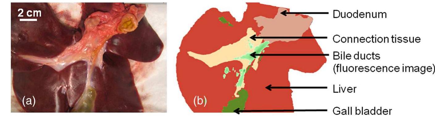 (a) photographic image of the biliary tissue structure. (b)