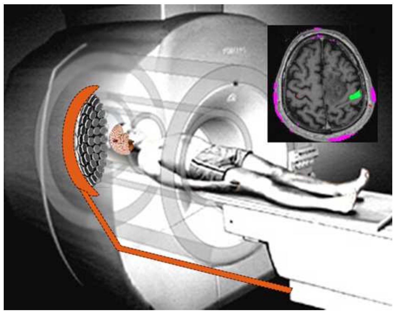 Targeting desired rois in the brain for stimulation with