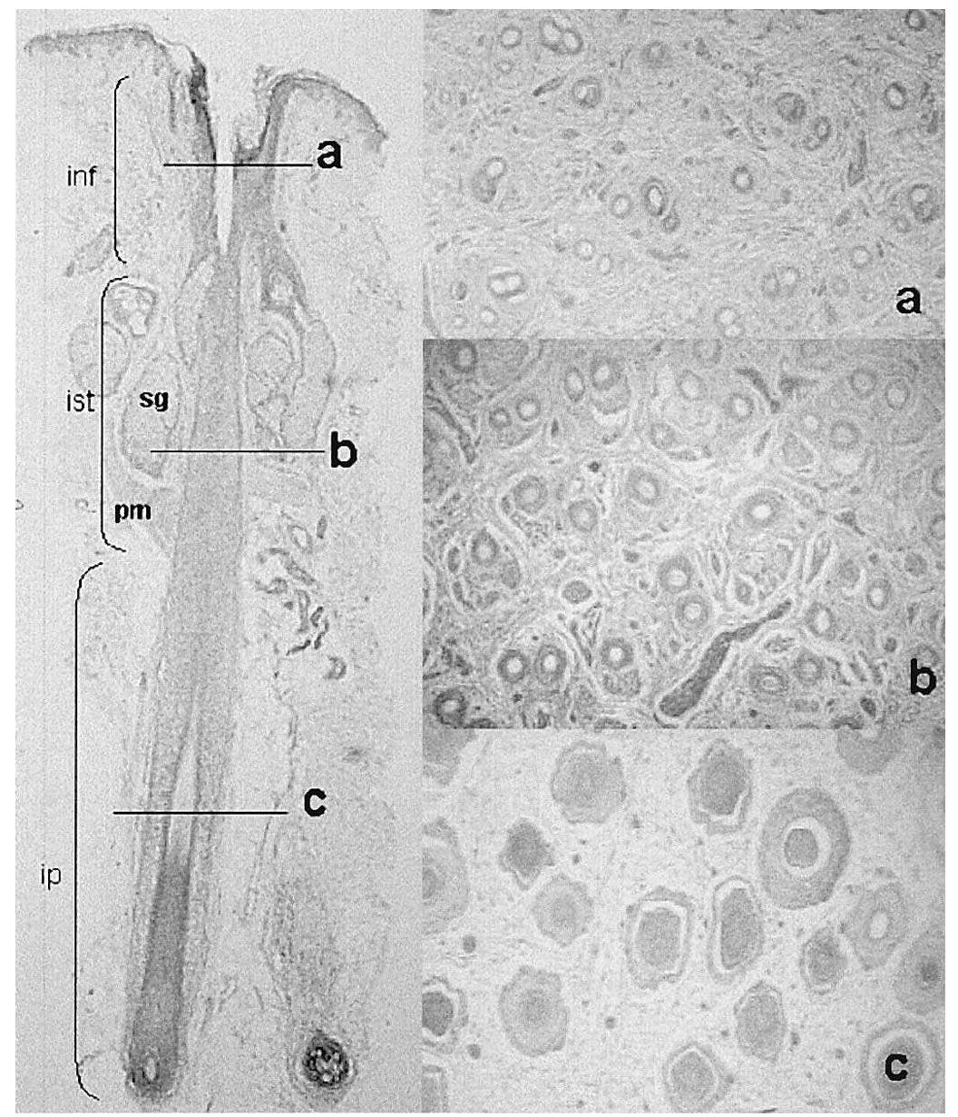 (PDF) The Arrector Pili Muscle and the Follicular Unit of the Scalp: A ...