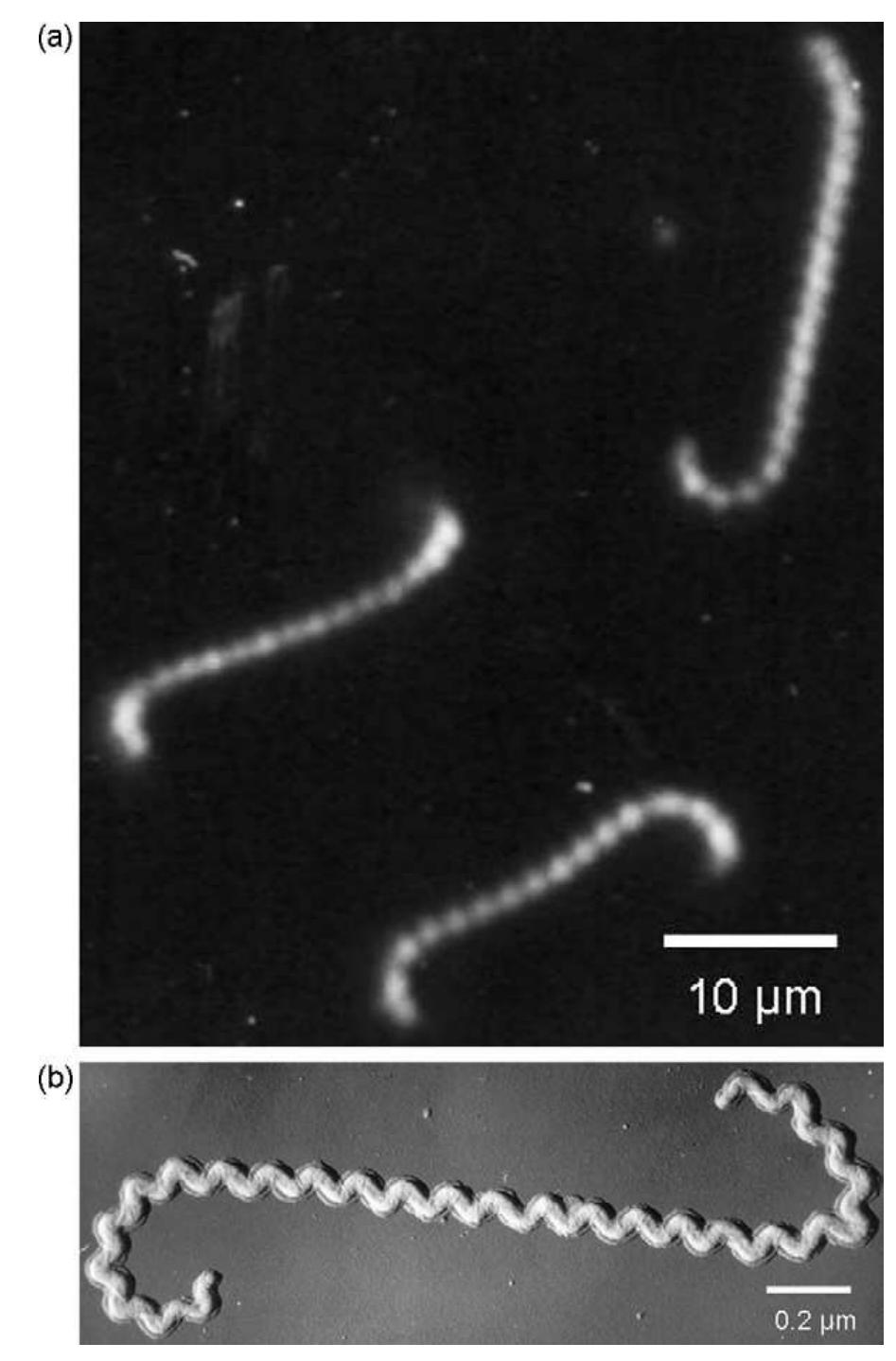 Figure 1 - from Leptospira and leptospirosis