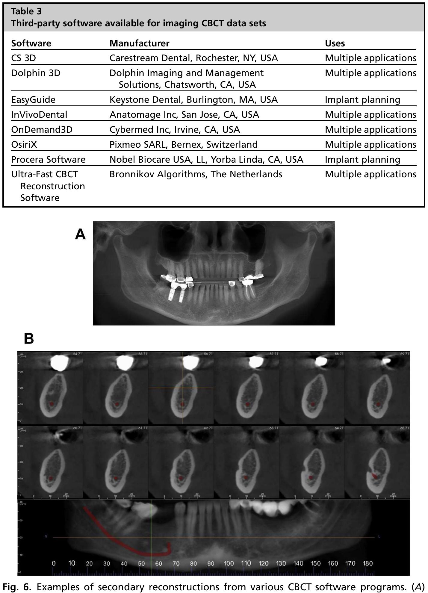 Figure 7 - Basic Principles of Cone Beam Computed Tomography