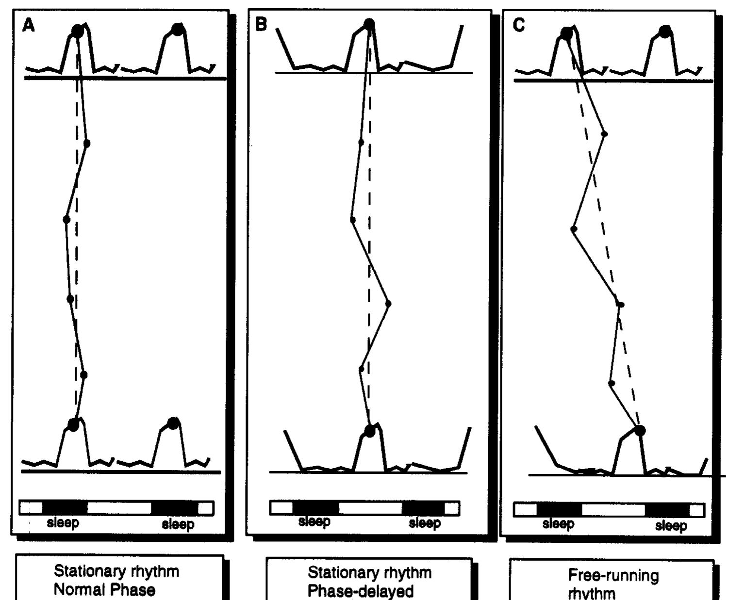 Outline of the major types of circadian rhythm disturbance