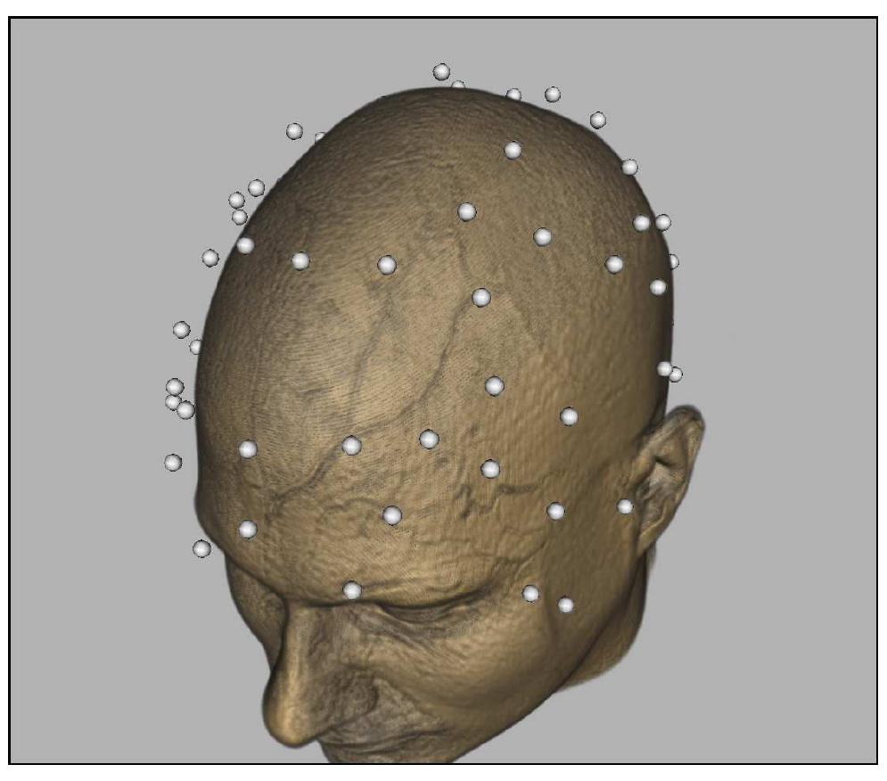 Registering sensor locations with mri-based data reveals the