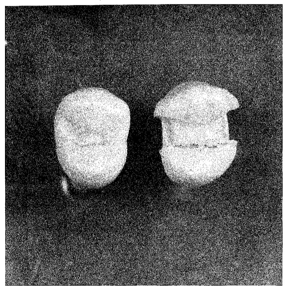 Occlusal view of an occlusal preparation and an mod