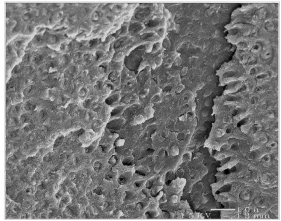 Dentin side of a debonded specimen restored incrementally