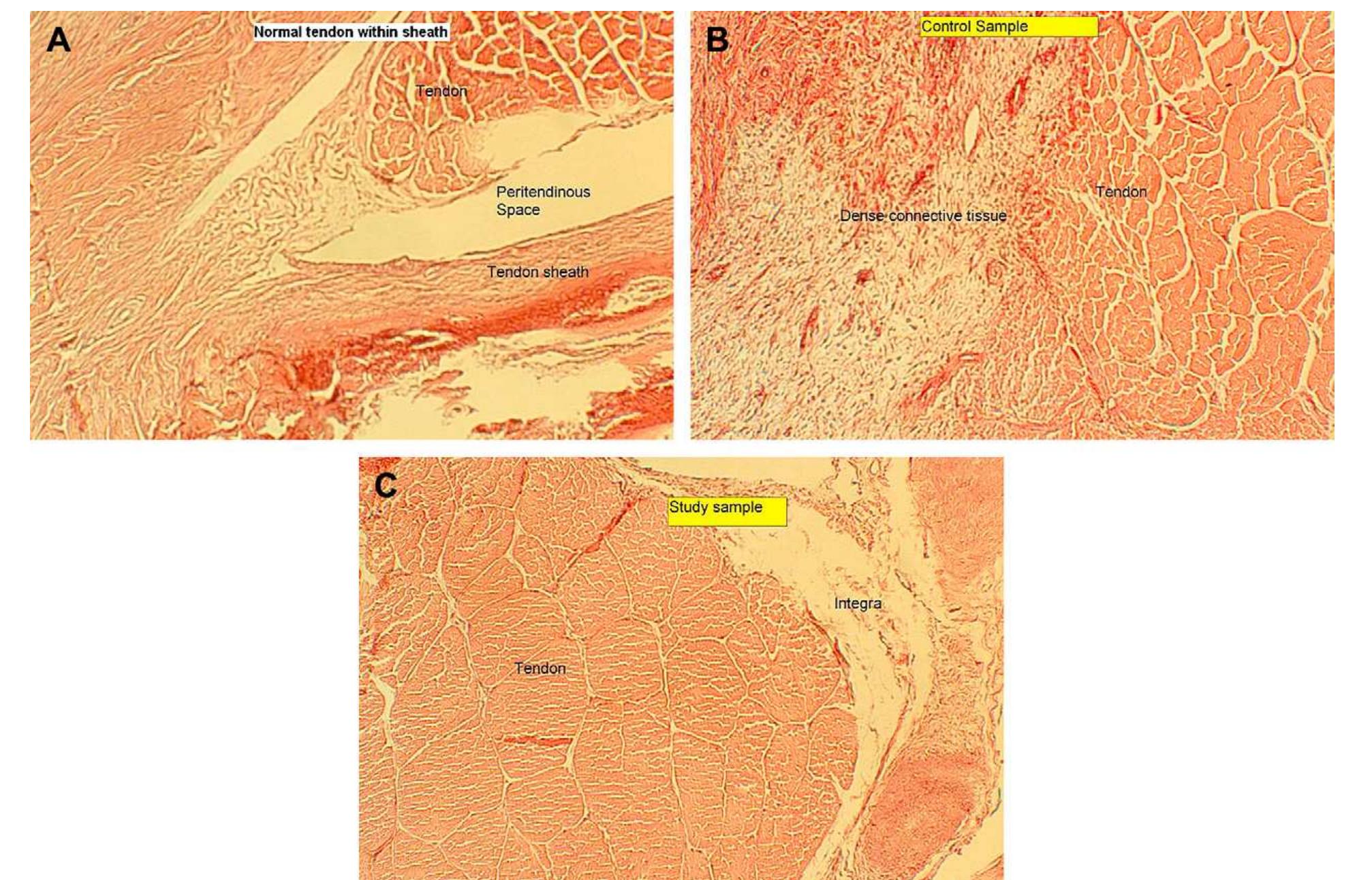 Histology of normal flexor tendon within its tendon sheath