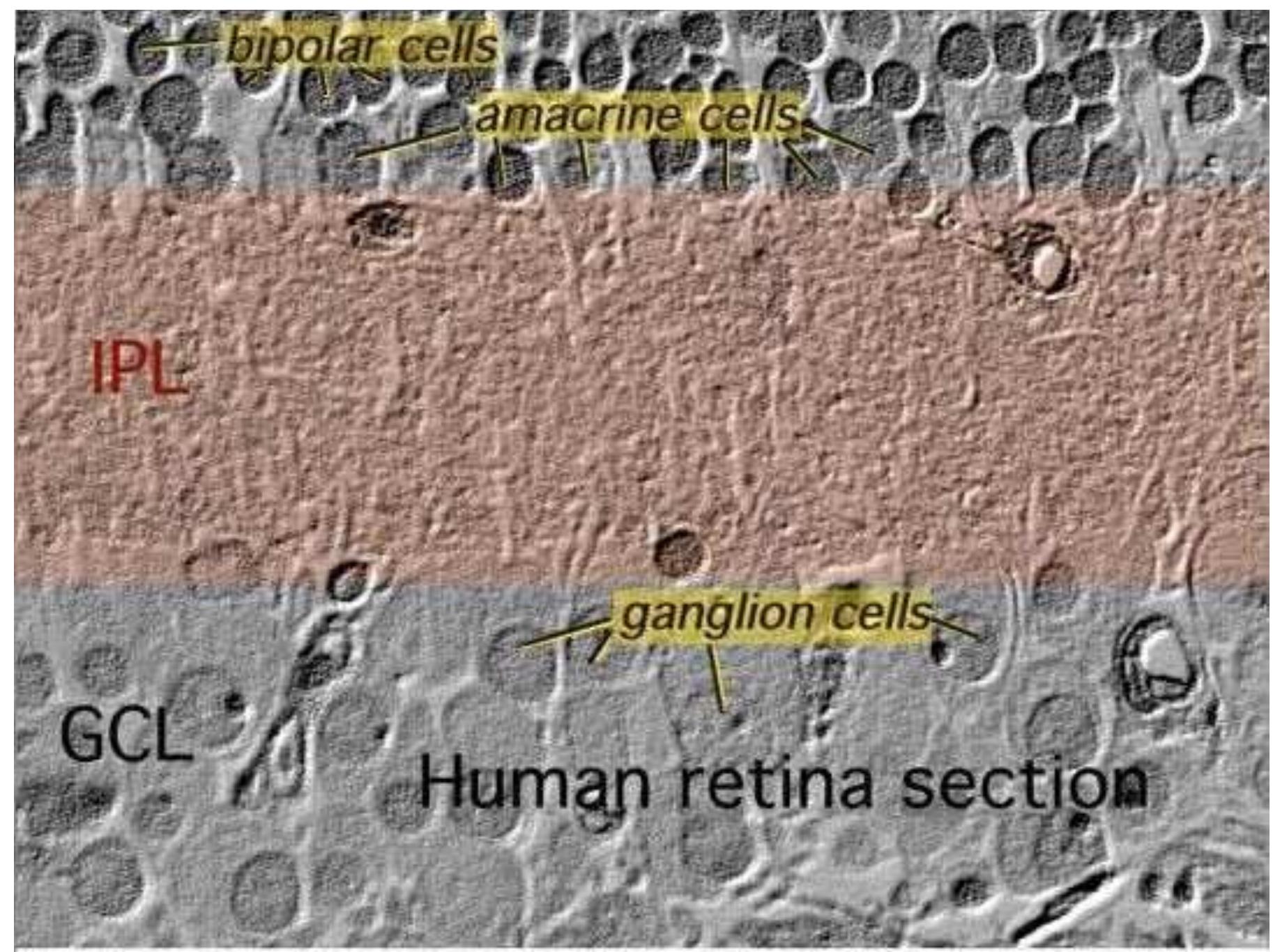 Figure 10 - Simple anatomy of the retina