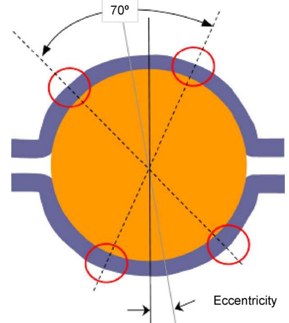 (PDF) Surface wrinkle defect of carbon steel in the hot bar rolling process