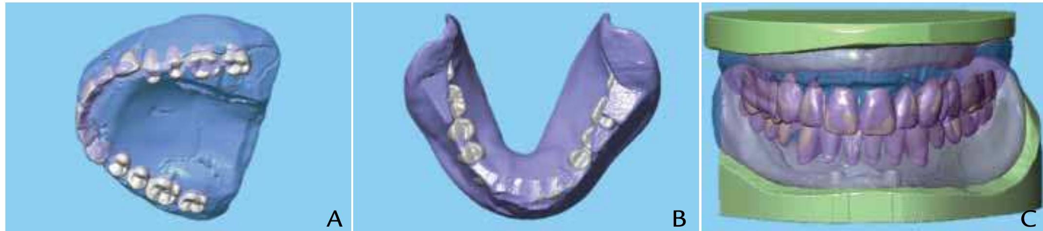Ei) a, scan of maxillary impression. b, scan of mandibular