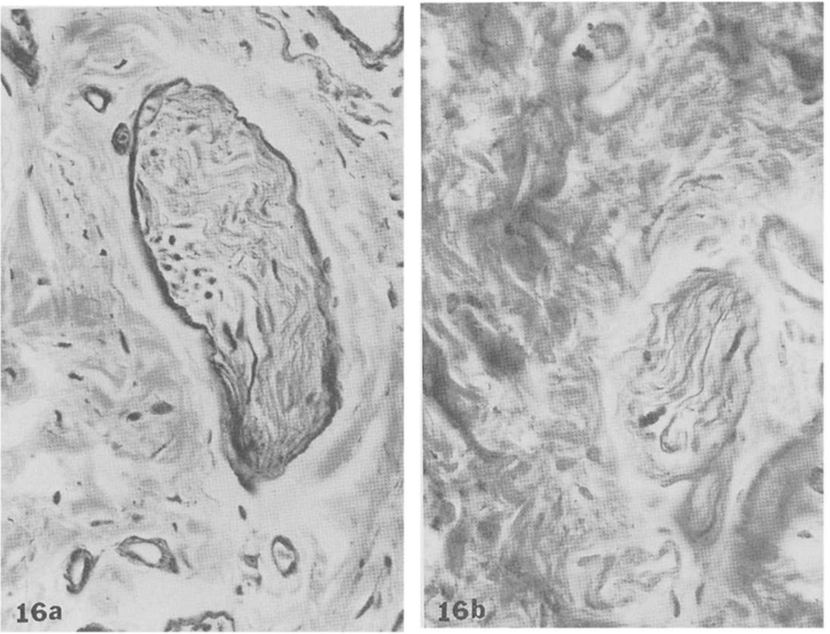 These two light micrographs are examples of small nerve