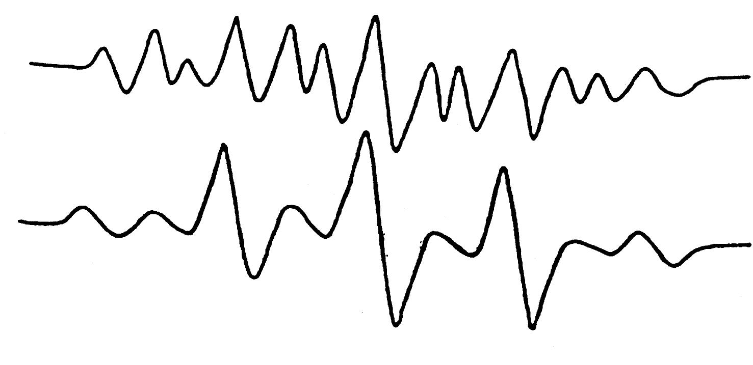 The 13- and 9-line epr spectra of radicals observed during
