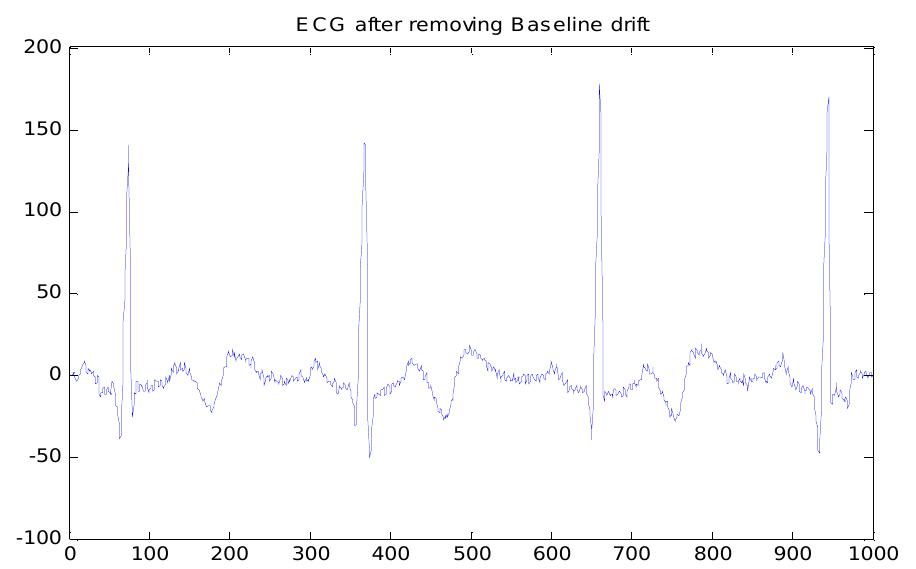 14: ecg after removing baseline drift (sample 1) fig 1.13:
