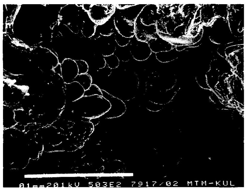 Fic. 3. shrinkage porosity in a steel casting (g-x 12 c1 14)
