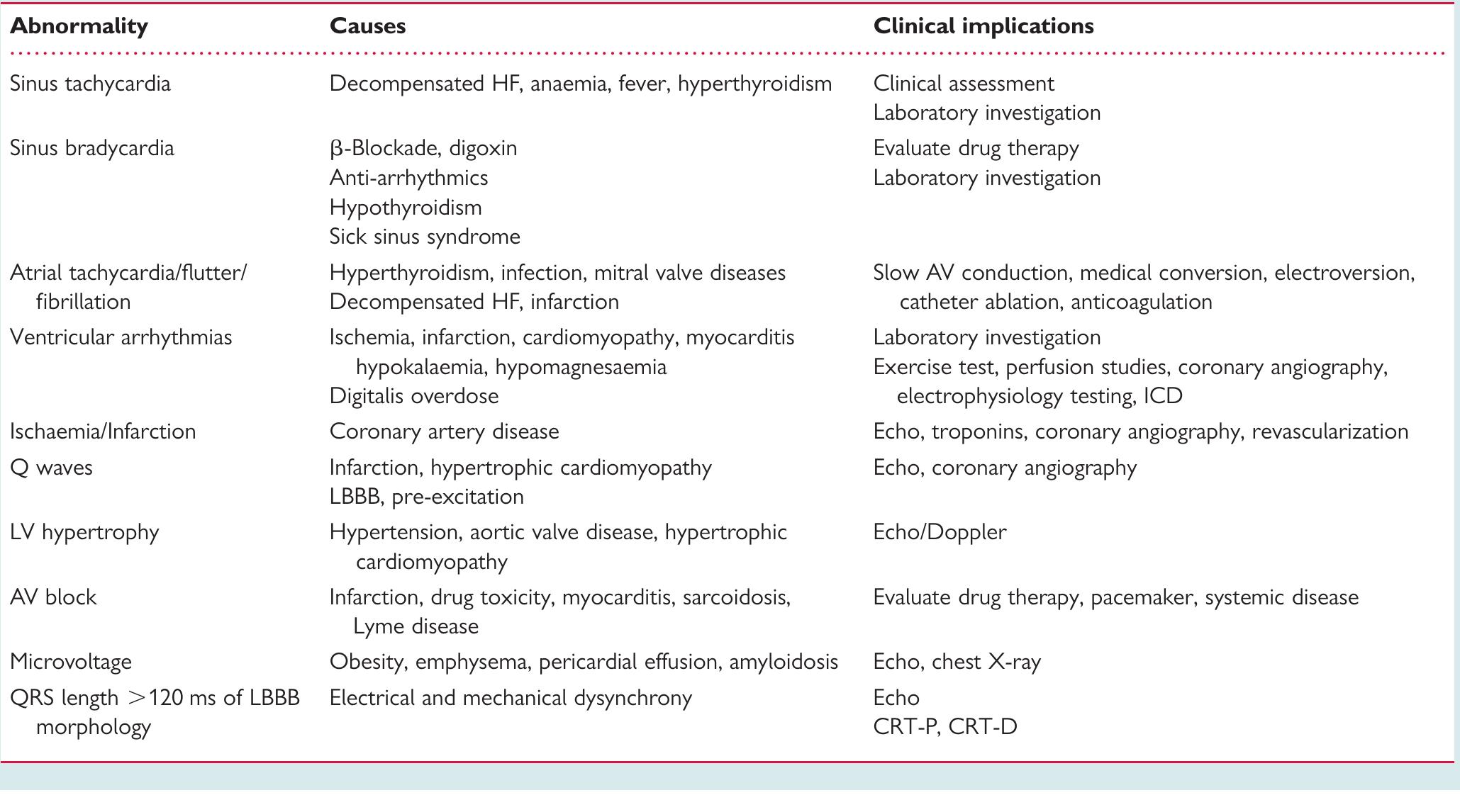 Common ecg abnormalities in heart failure
