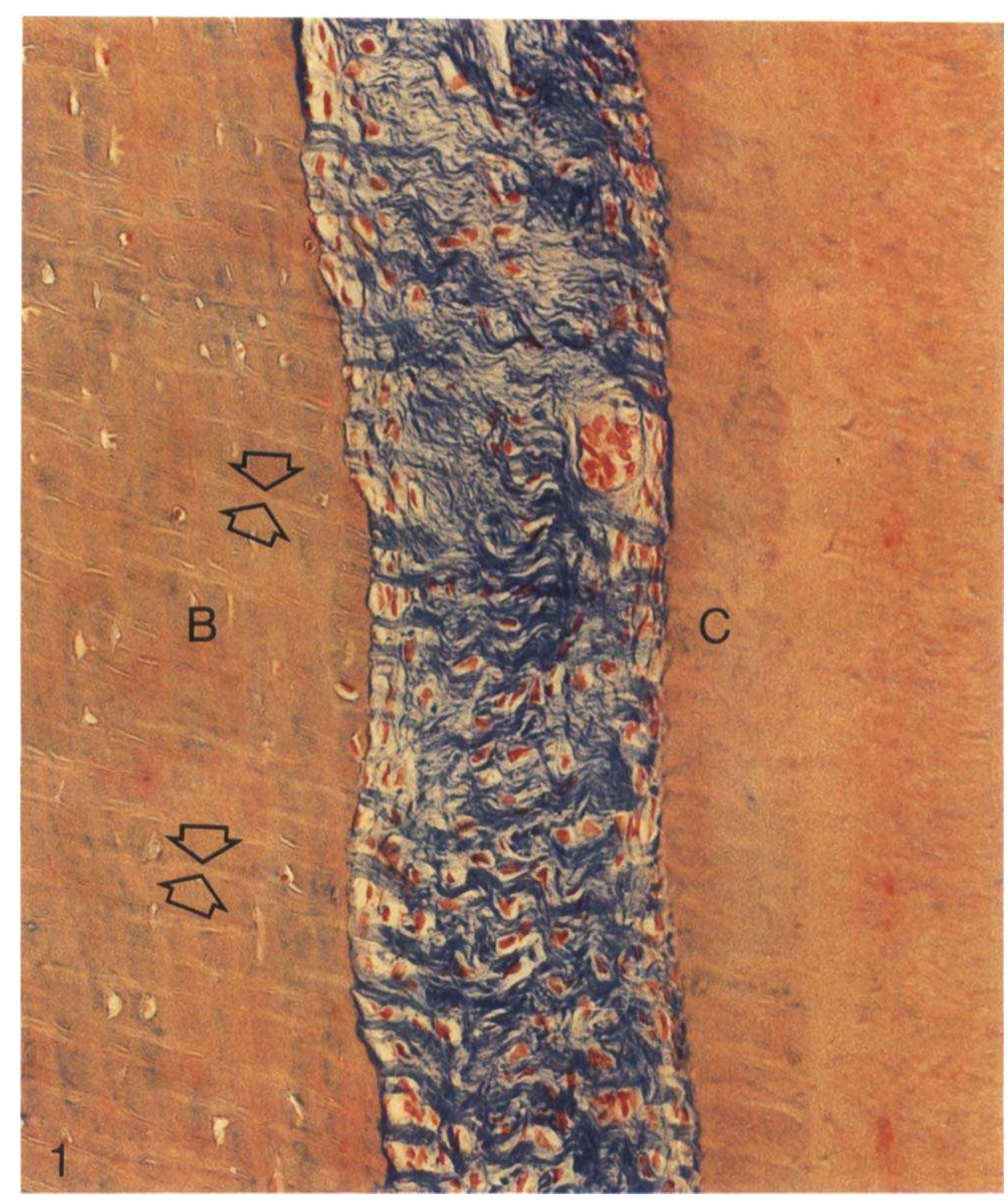 Light micrograph of human periodontal ligament showing the