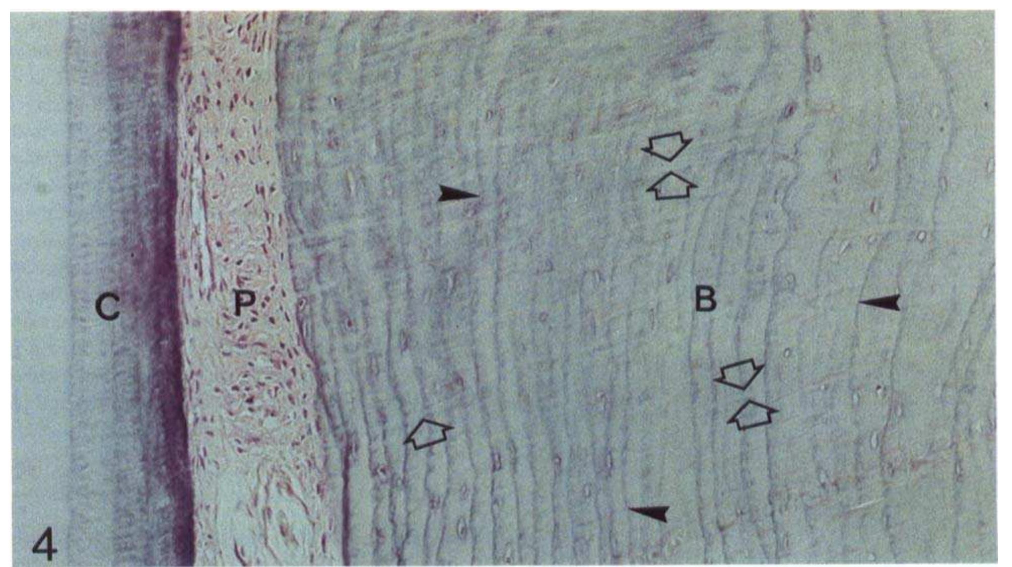 Light micrograph of distal aspect of human pre- molar. note